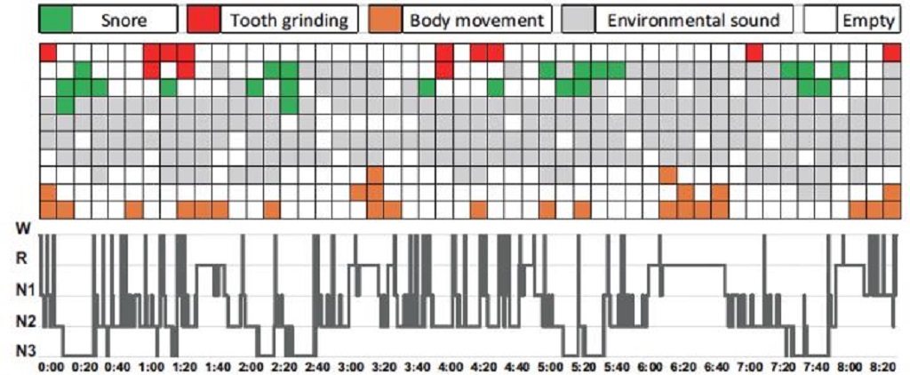 Are You Getting Enough? (Sleep): Sleep Patterns and Sounds - Trebuchet